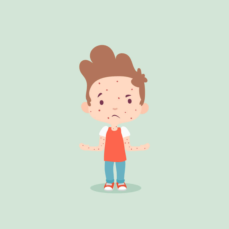 Quanto tempo dura a catapora? - Dra. Marice El Achkar Mello ...